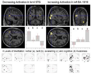 Evidence from fMRI and EEG scans – Sunyata Meditation